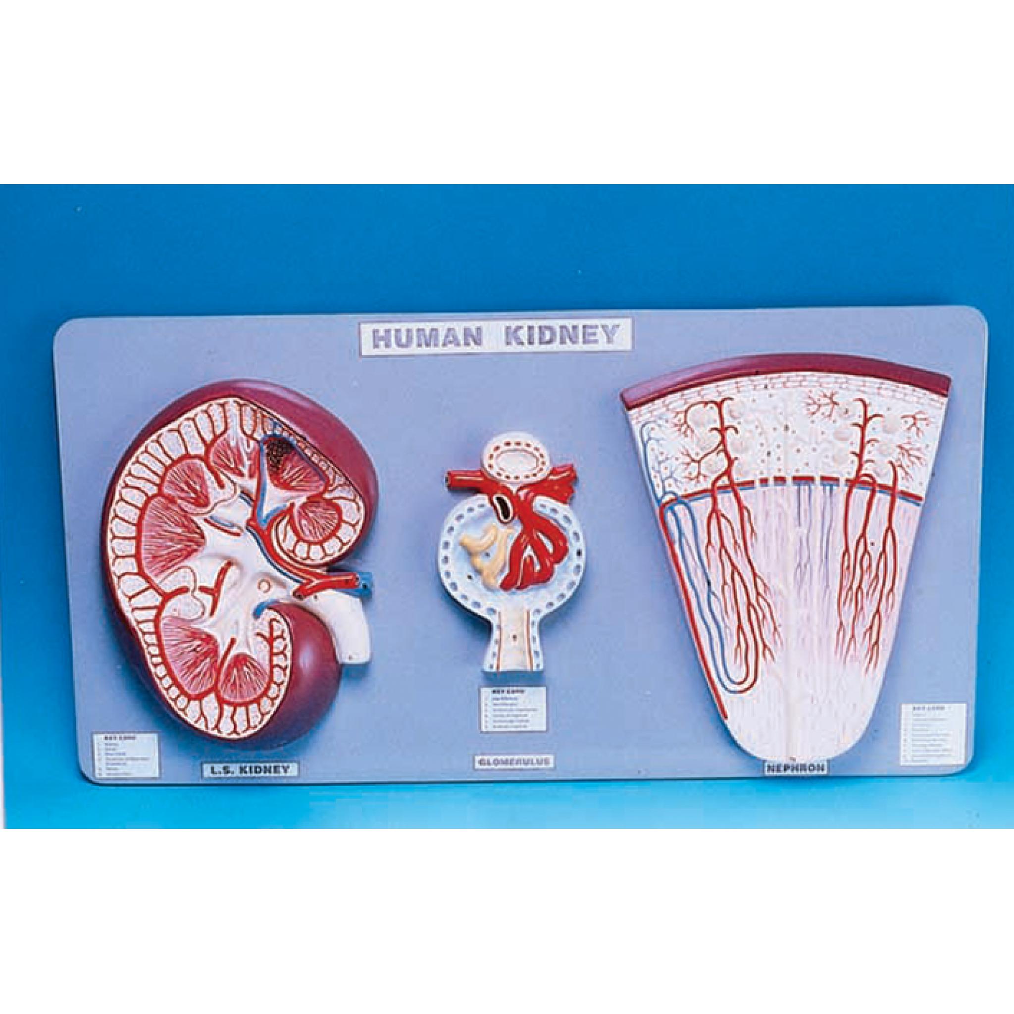 Kidney Section, Nephrons, Blood Vessels And Renal Corpuscle