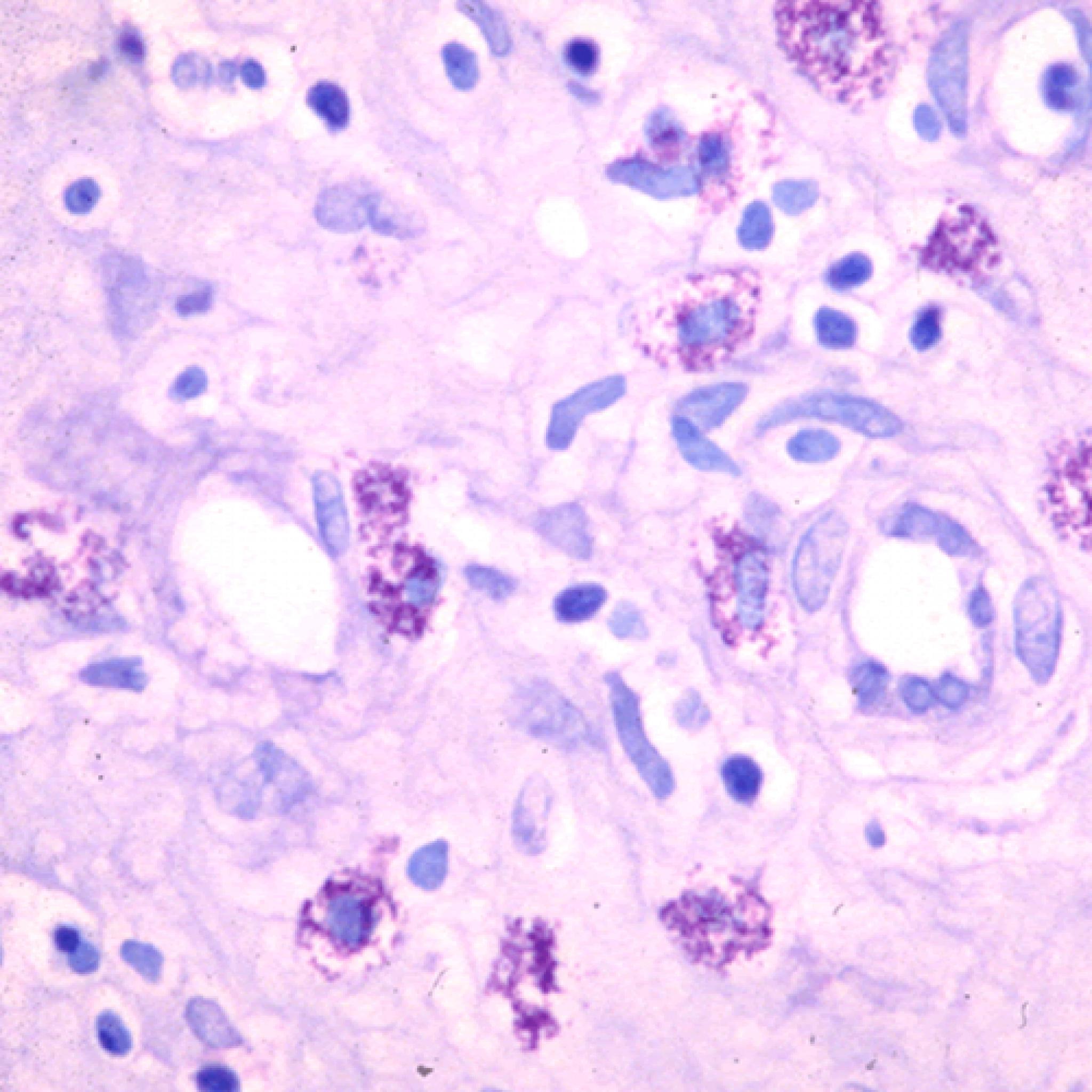 Toluidine Blue (1% Aqueous) 100ml