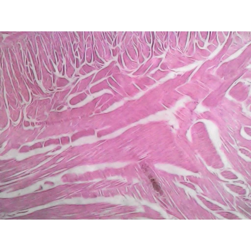 MICROSCOPE SLIDE - Insect trachea