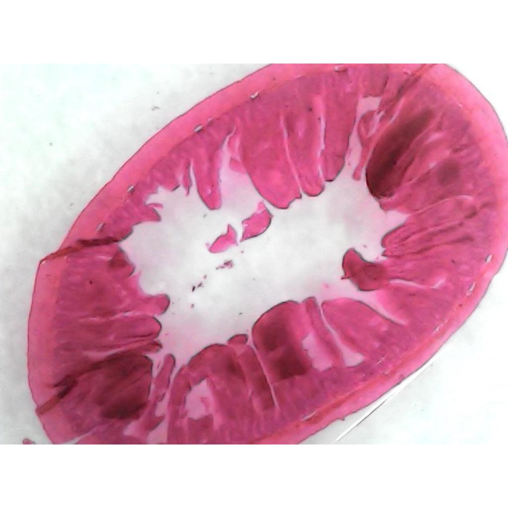 MICROSCOPE SLIDE - Insect trachea