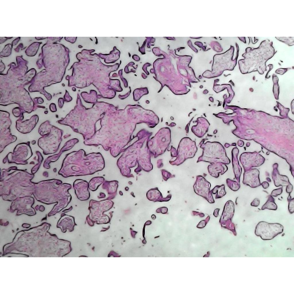MICROSCOPE SLIDE - Insect trachea