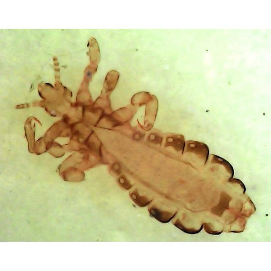 MICROSCOPE SLIDE - Insect trachea