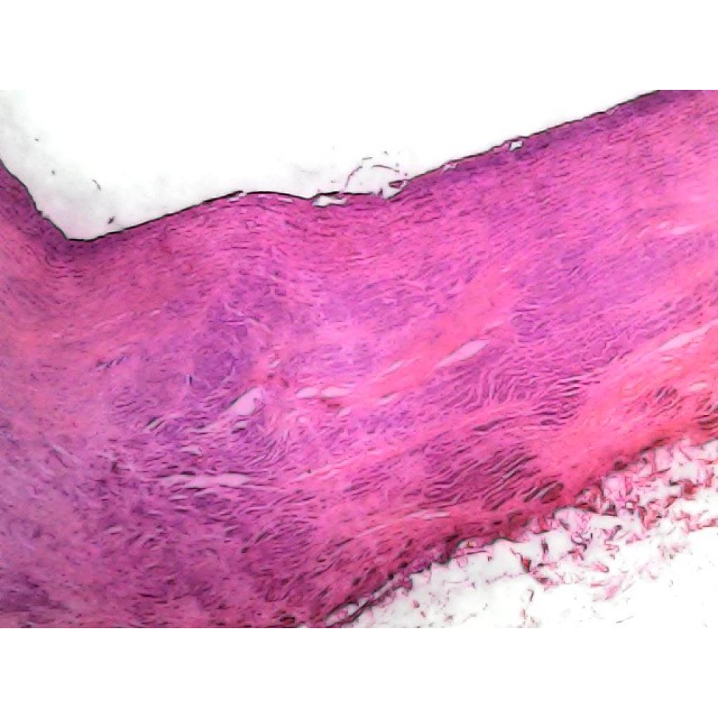 MICROSCOPE SLIDE - Insect trachea