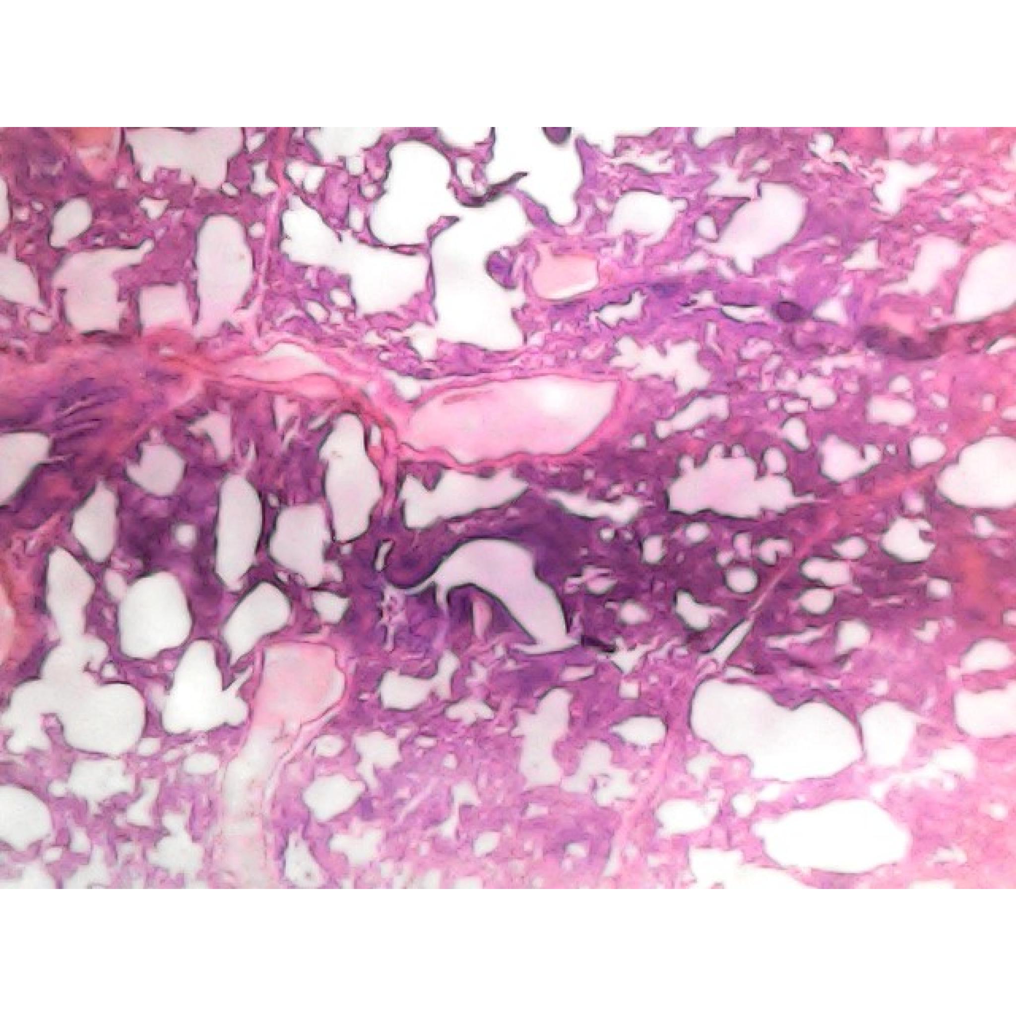MICROSCOPE SLIDE - Insect trachea