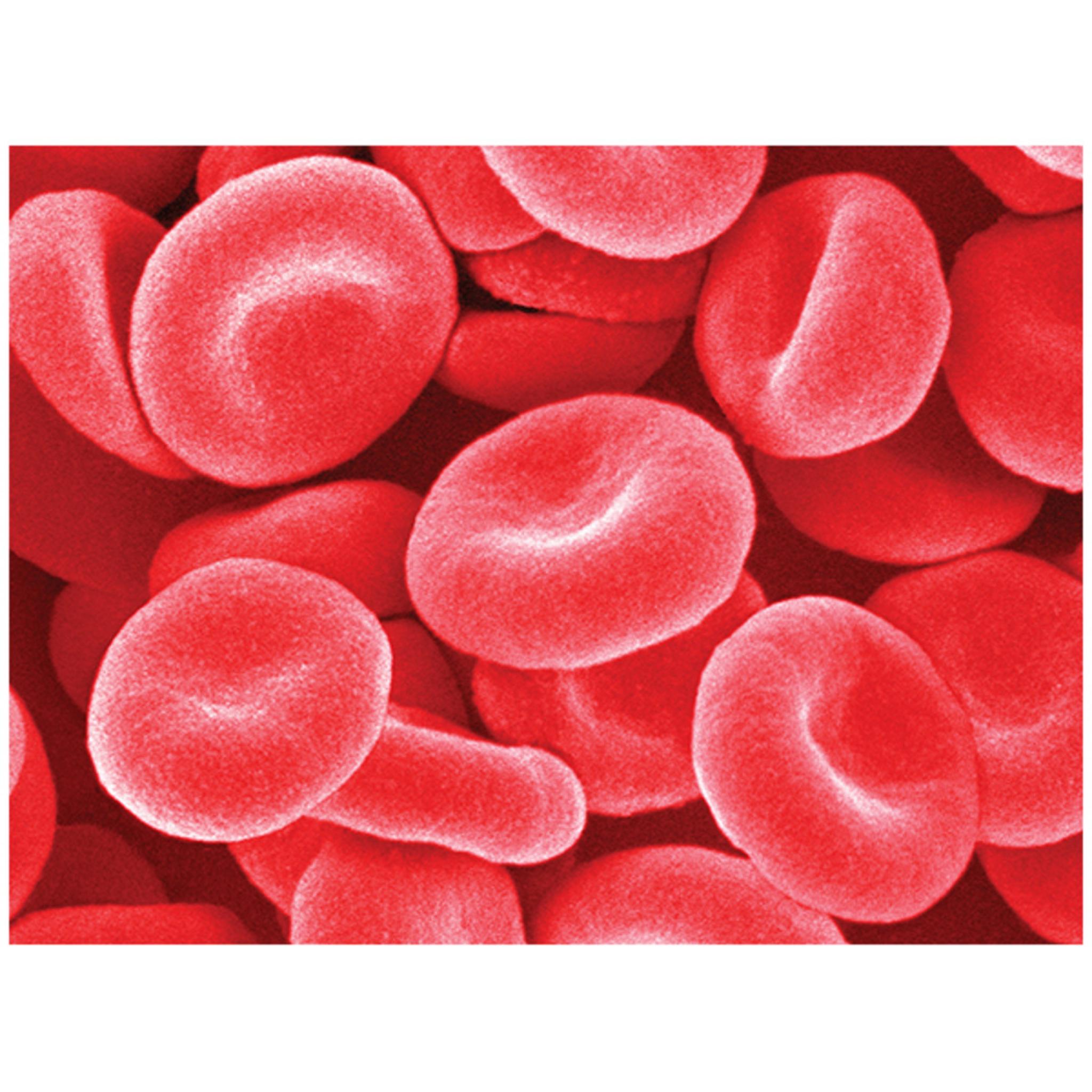 Forensics Blood Typing