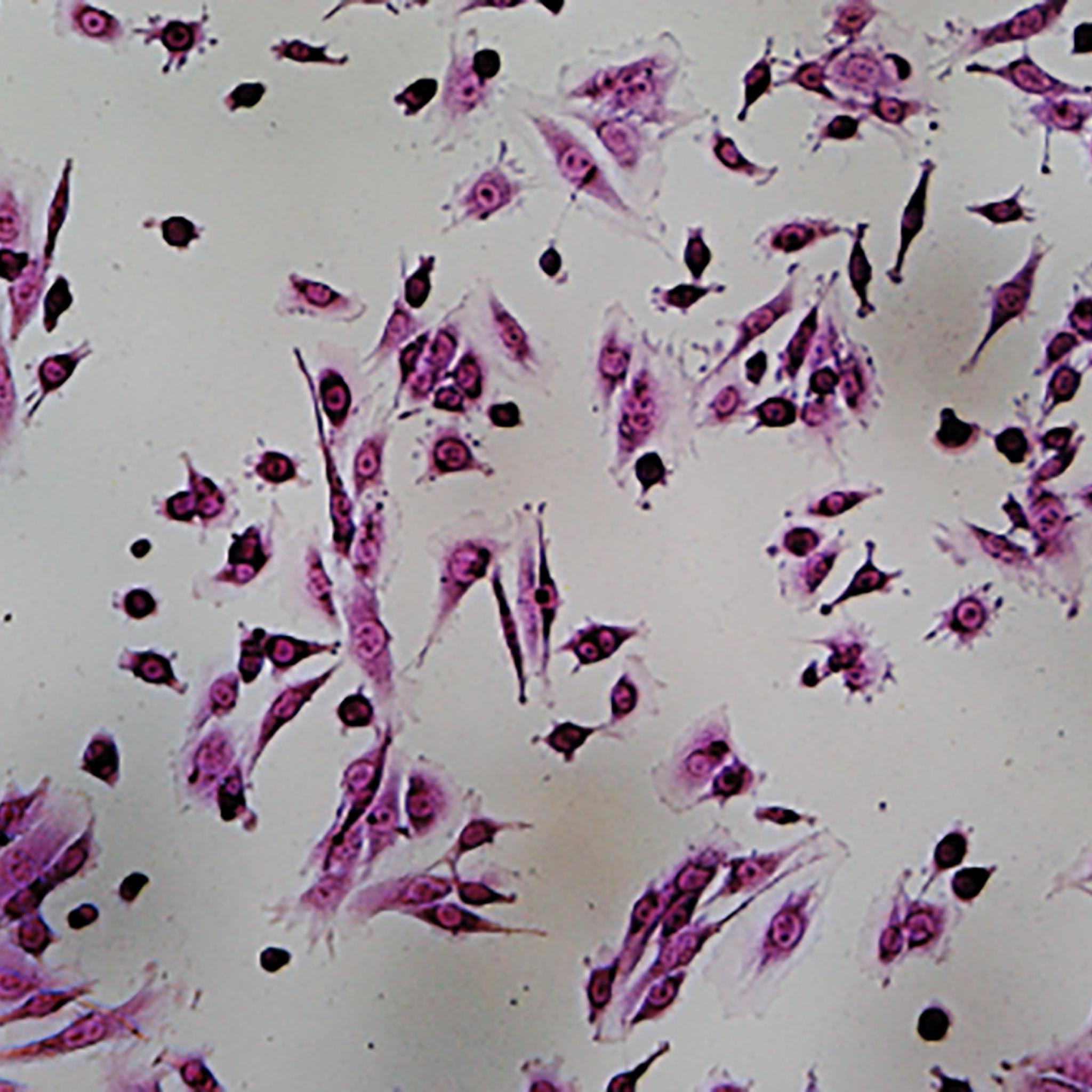 Morphology of Cancer Cells