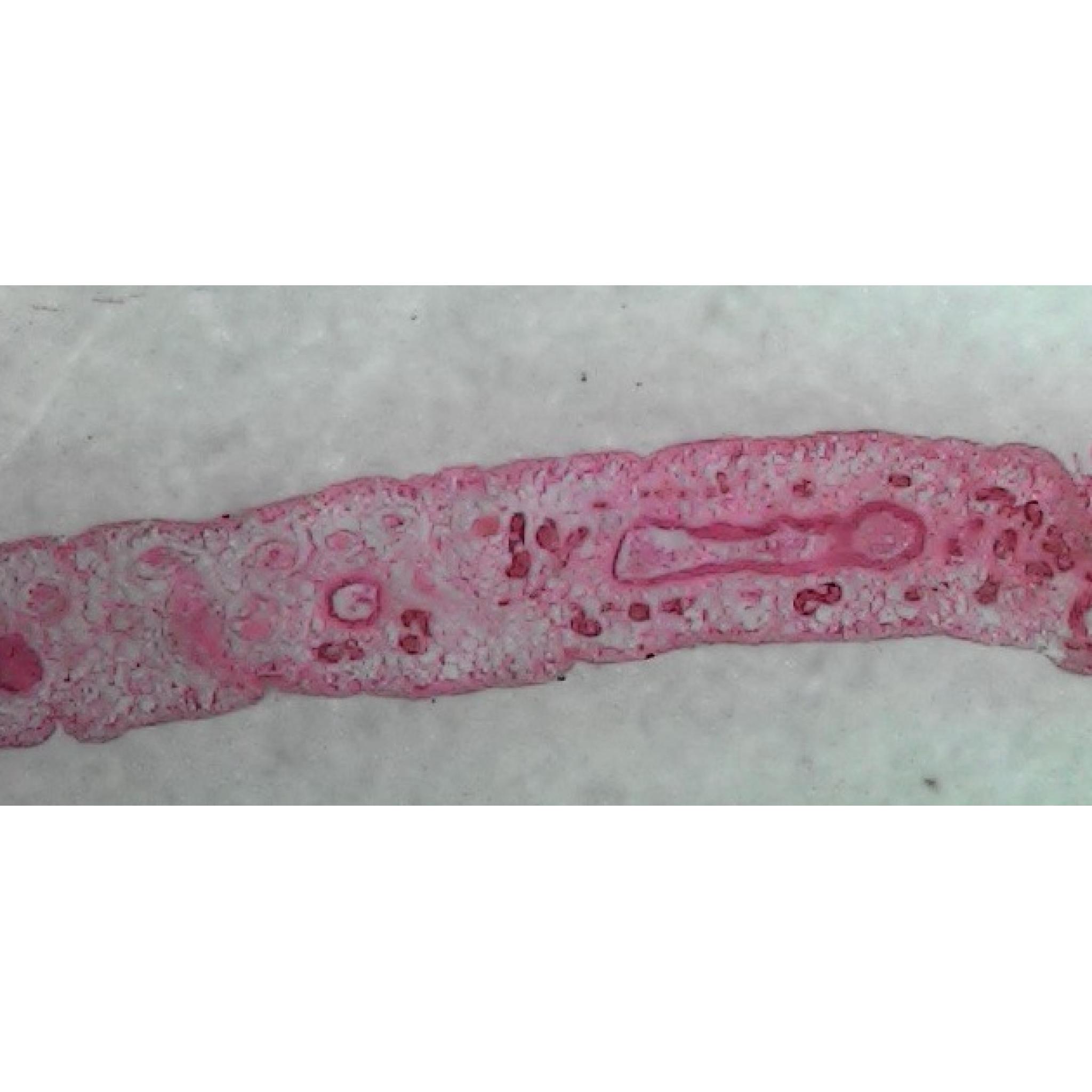 MICROSCOPE SLIDE - Insect trachea