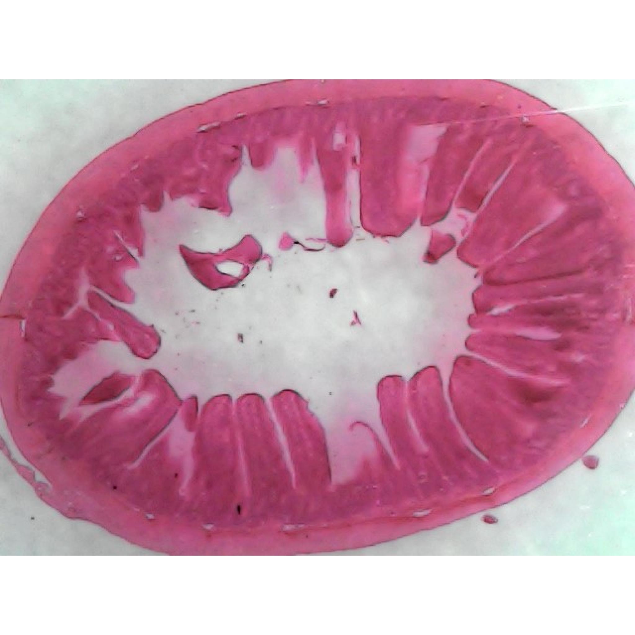 MICROSCOPE SLIDE - Insect trachea