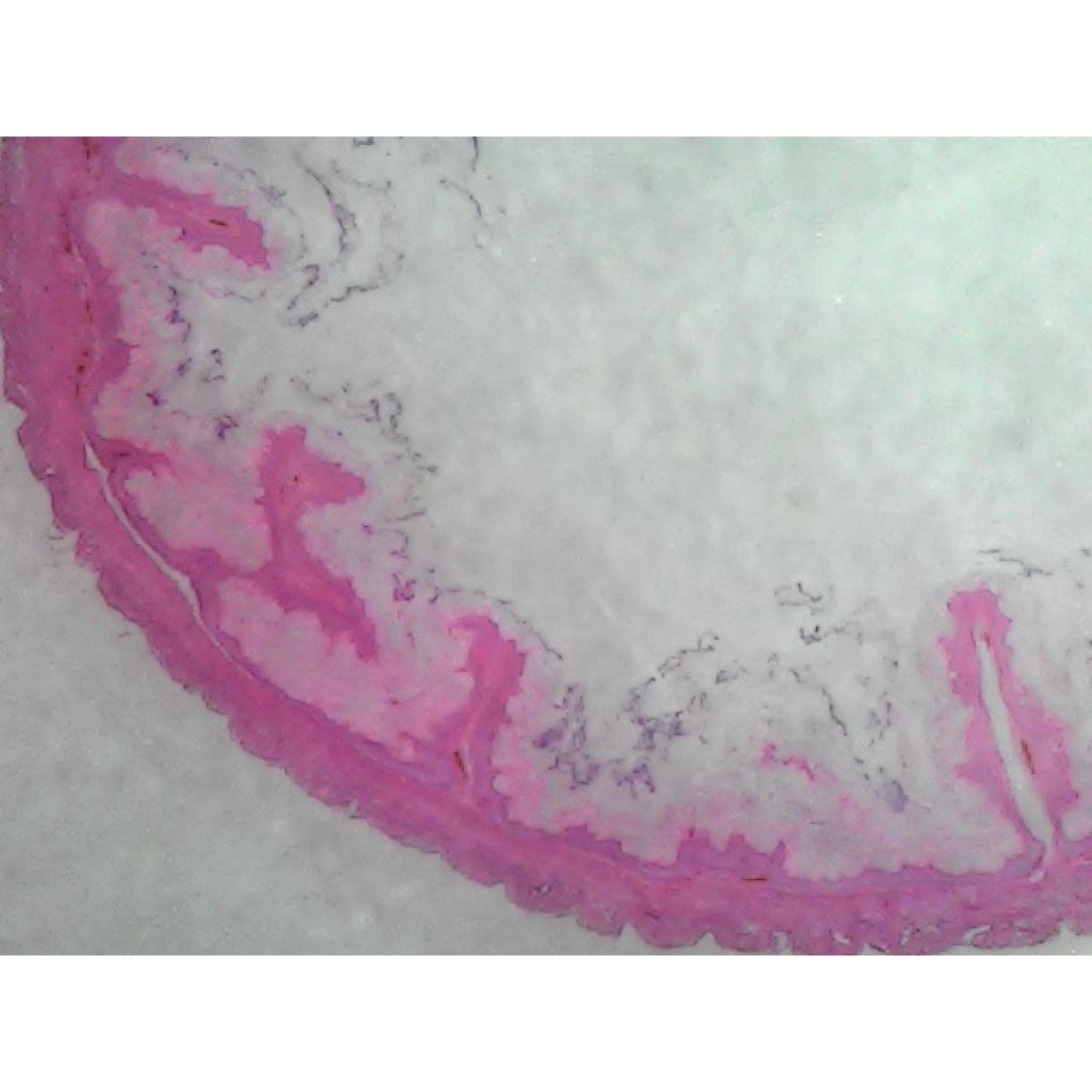 MICROSCOPE SLIDE - Insect trachea