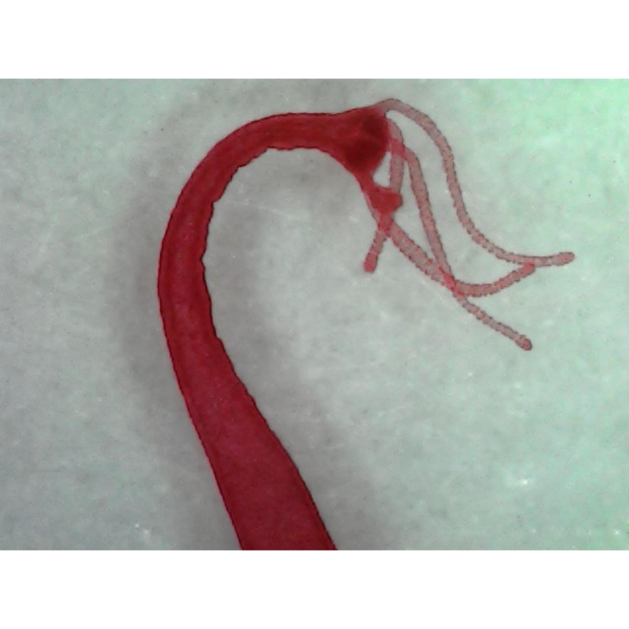 MICROSCOPE SLIDE - Insect trachea