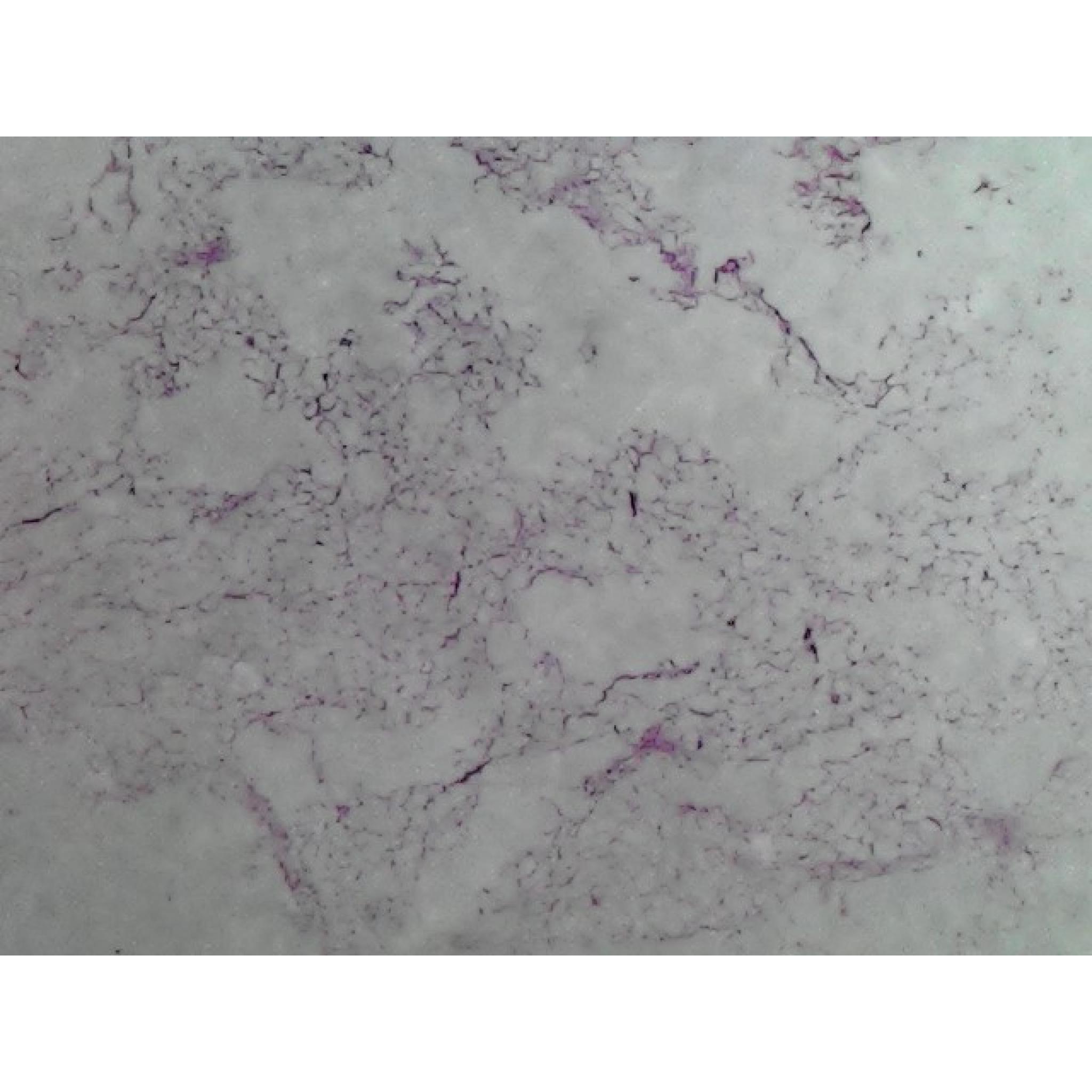 MICROSCOPE SLIDE - Insect trachea