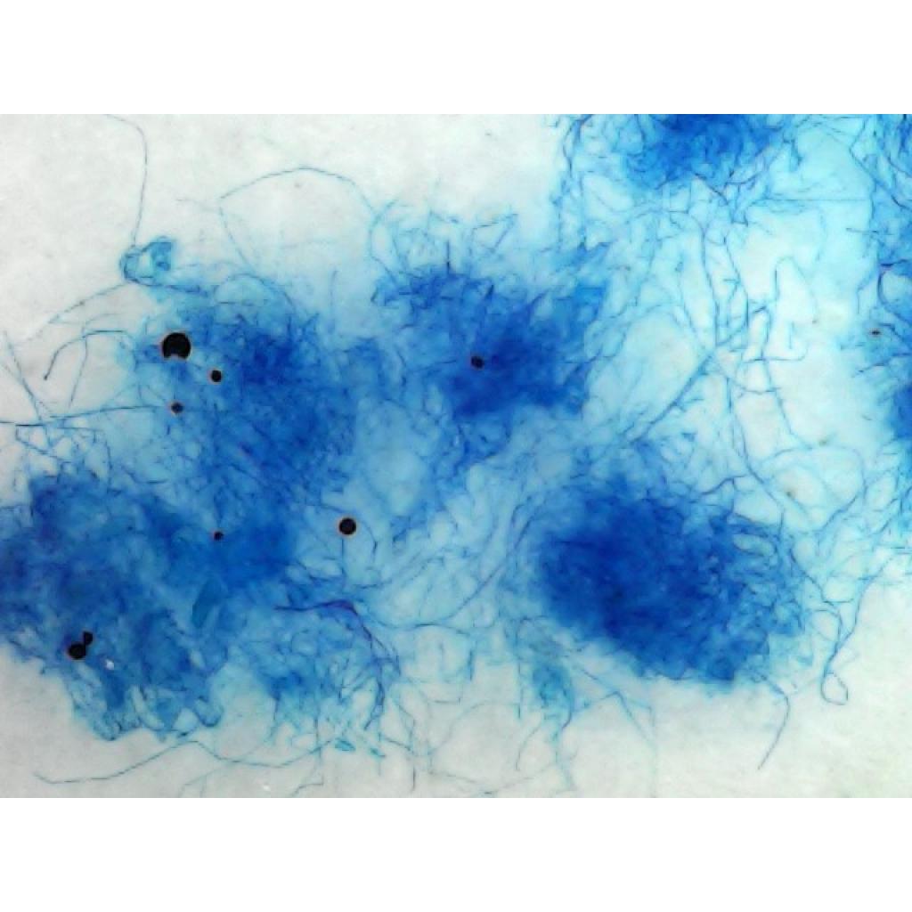 MICROSCOPE SLIDE - Insect trachea
