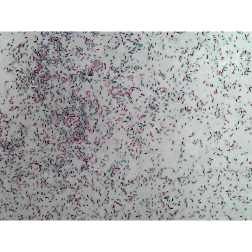 MICROSCOPE SLIDE - Insect trachea