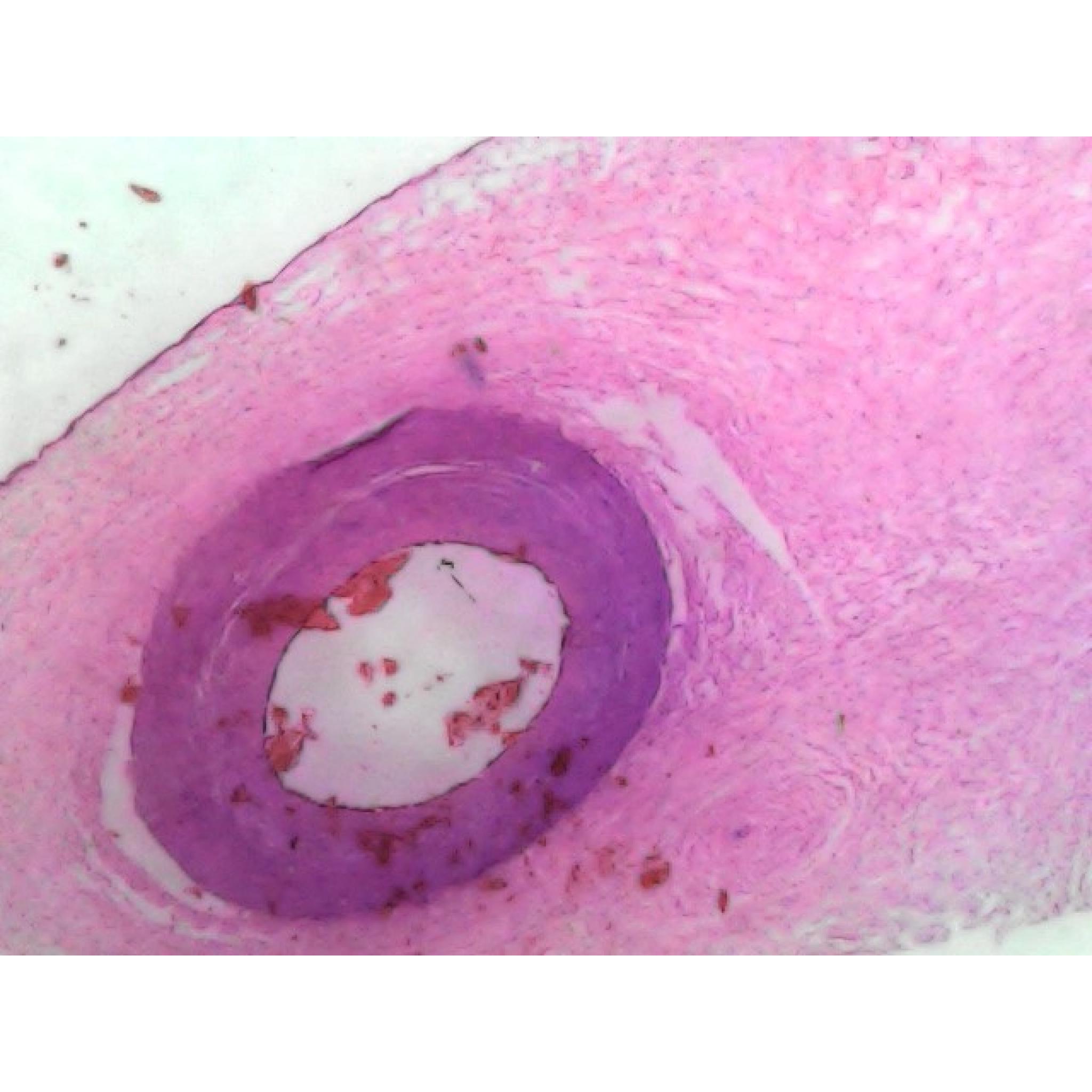 MICROSCOPE SLIDE - Insect trachea