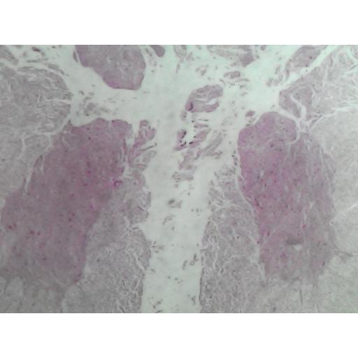 MICROSCOPE SLIDE - NERVE CELL