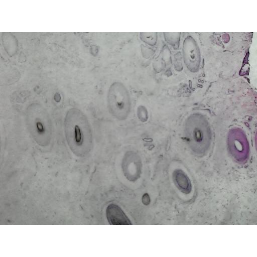 MICROSCOPE SLIDE - HUMAN SKIN