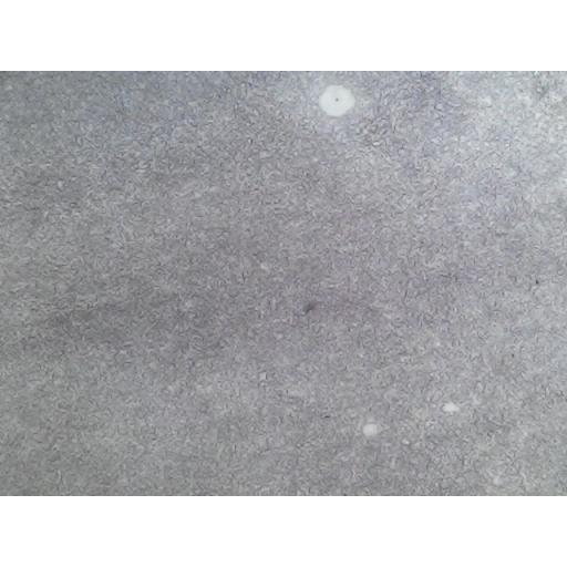 MICROSCOPE SLIDE - BLOOD SMEAR